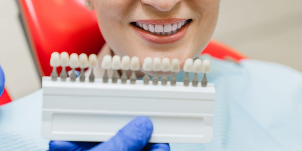 Color De Tus Dientes Qué Son Las Fundas Dentales? | Clínica Dental